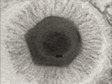 [Audio] Infectólogo: Descubrimiento del megavirus sirve para saber cómo ...