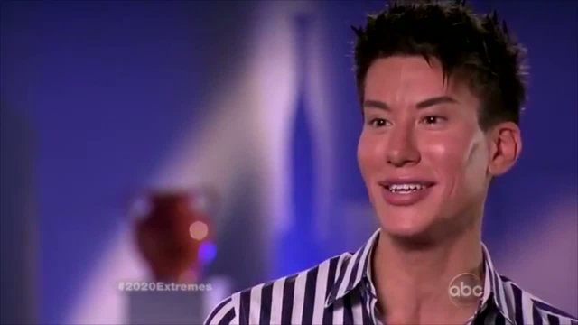 [Video] Se operó 90 veces para parecerse a Ken - Cooperativa.cl