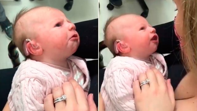 [Video] La emocionante reacción de una bebé con sordera al escuchar por ...